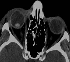 Fig. 5: 21 year old female patient presenting withtrauma. Imaging ...
