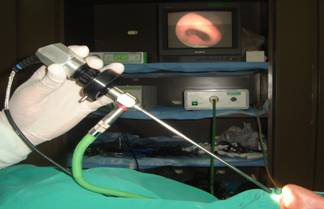 Fig. 1 . Endoscope with cameraand projection on monitor