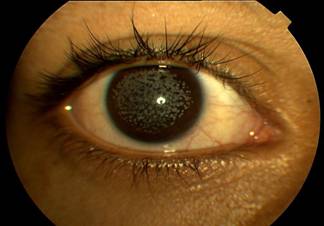 440909_20071207_084943_Color_L_04